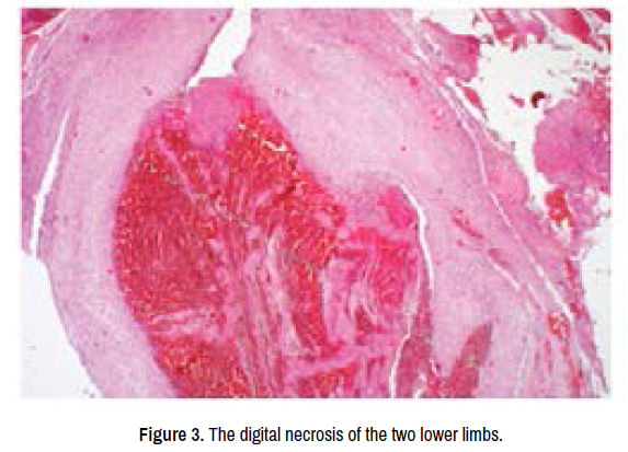 clinical-case-reports-two lower
