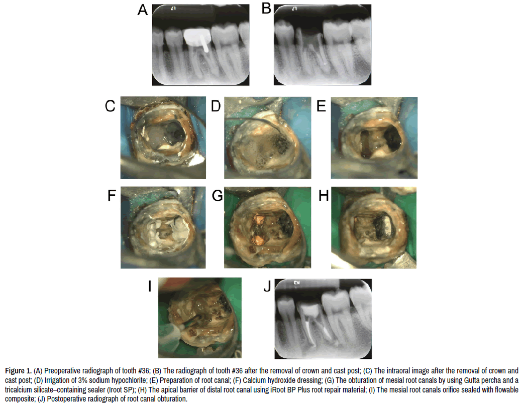 clinical-case-reports-silicate–containing
